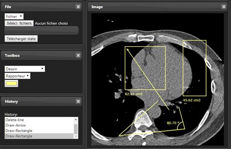 How To Reinitialize Dicom Image After Drawing On It Issue 472
