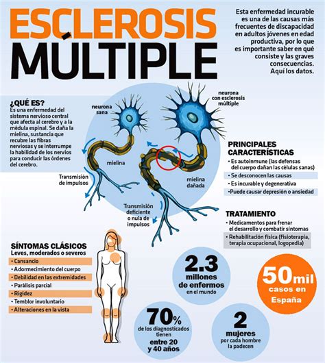 Esclerosis Múltiple Rehabilitación Y Tratamiento Primera Edición