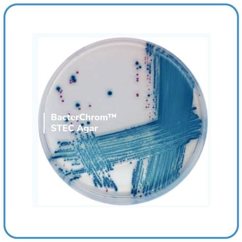 Bacterchrom™ Candida Agar Bacterlab