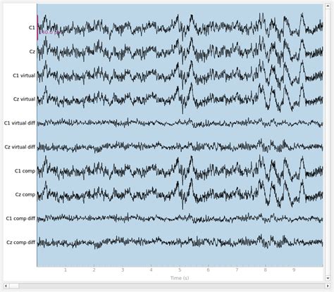 Identify Eeg Electrodes Bridged By Too Much Gel — Mne 180 Documentation
