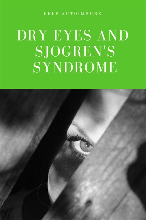 Dry Eye In Sjogrens Patients In 2022 Dry Eyes Evidence Based