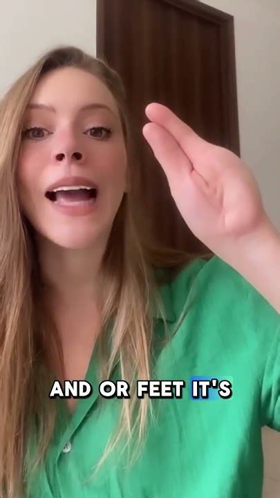 What Is Ectrodactyly Trending Usa Fypshorts Fyp Youtube