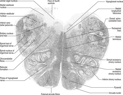 Reticular Formation Cross Section