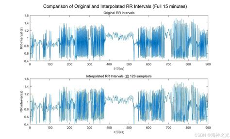 【心电信号ecg】基于matlab Ecg心电信号心率变异性（处理原始数据、识别心跳、计算rr间隔并分析）【含matlab源码 10921期