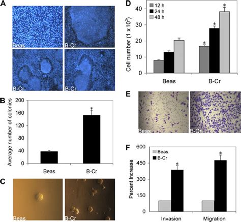 Hexavalent Chromium Cr Vi Induced Malignant Transformation Of Human Download Scientific