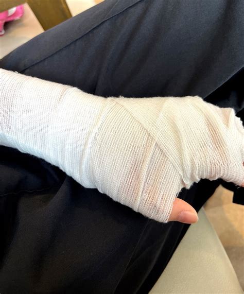 小4娘ちゃんのギプス。 ＊大家族mama＊日々の暮らしを楽しんでます＊