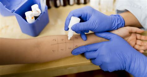 Allergy Testing What It Is And What To Expect GMP Medical Hialeah