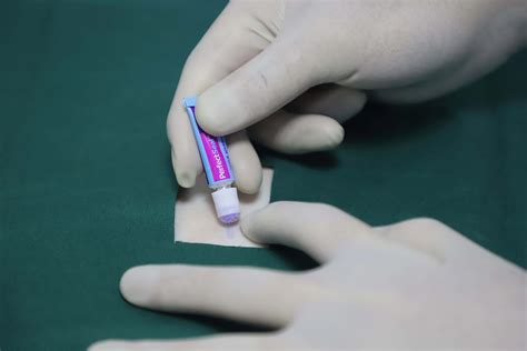 Source 2 Octyl Cyanoacrylate Medical Glue Tissue Adhesive 59 Off