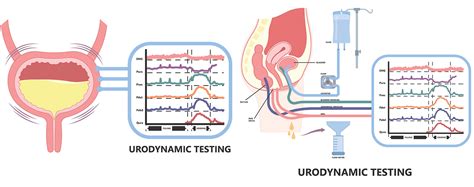 Tackling Urogynecological Problems Dubai London Hospital