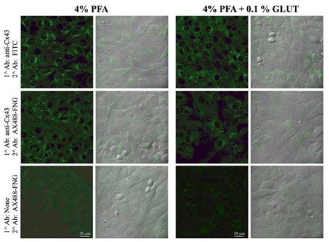 Correlative Microscopy For Localization Of Proteins Creative Diagnostics