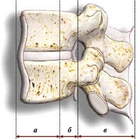 Burst Fractures According To F Denis Classification Download Scientific Diagram