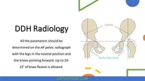 Orthofixar Orthopedic Surgery On Linkedin Ddh Radiology Ddh