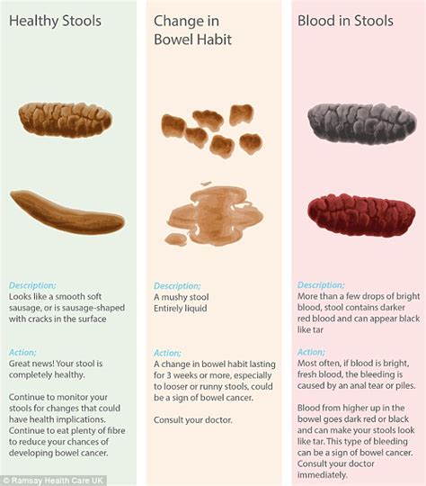 Is It Piles Or Bowel Cancer Daily Mail Online
