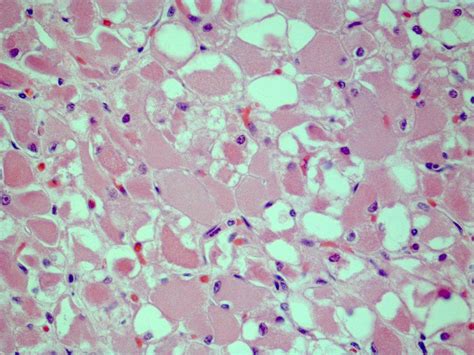 Histology Of Thyroid Gland