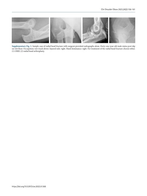 Pdf Variation In Radial Head Fracture Treatment Recommendations In