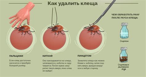 Оказание первой помощи при укусах насекомых: клещи, пчелы, осы, шершни
