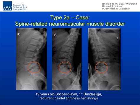 Bryan English Classification Of Muscle Injuries In Sport Pdf