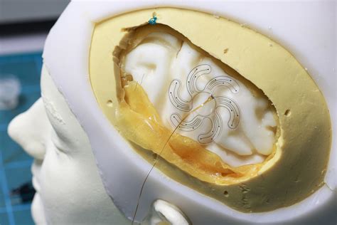 Iem Biomedical Engineering Sti School Of Engineering Epfl