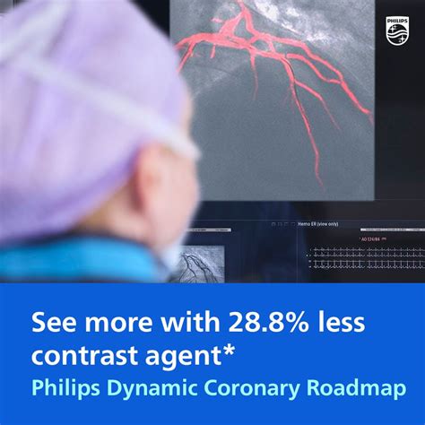 Philips On Linkedin Coronary Artery Disease Philips