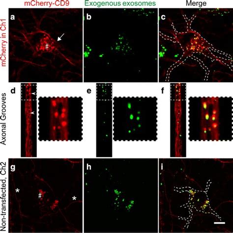 Super Resolution Microscopy Reveals That Endosomes Can Carry Both