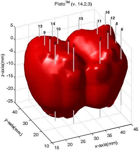 Brachytherapy Dosimetry