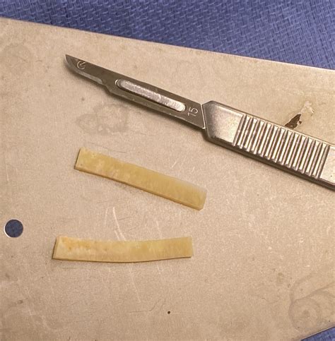 Cadaveric Rib Cartilage Wedges Dr Barry Eppley Explore Plastic Surgery