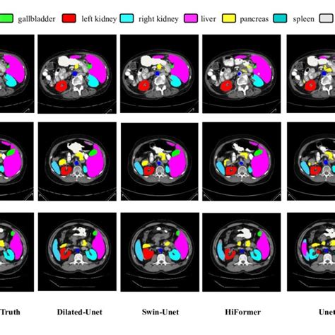comparative segmentation results on the synapse dataset download