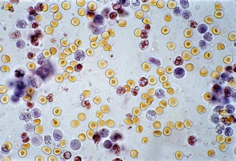 6 Examination Of Urinary Sediment Veterian Key