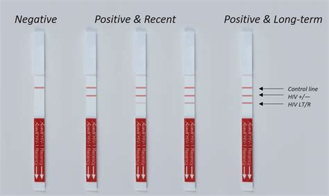 Asanté® Hiv 1 Rapid Recency® Sedia Biosciences