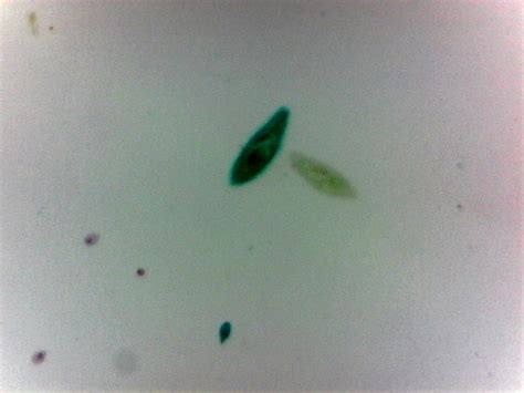 Protozoa Under Microscope