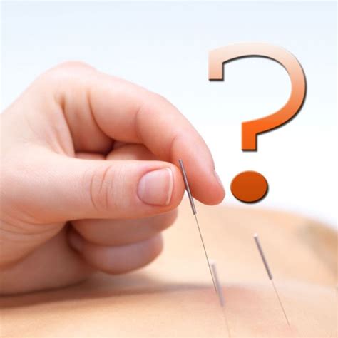 Acupuncture Points Body Quiz By Alexander Mokrushin