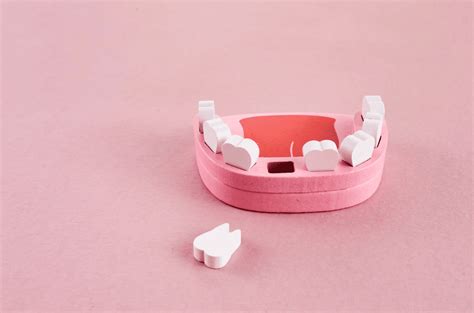 How To Fix Missing Teeth Causes And Treatments Smith And Jain Dentists