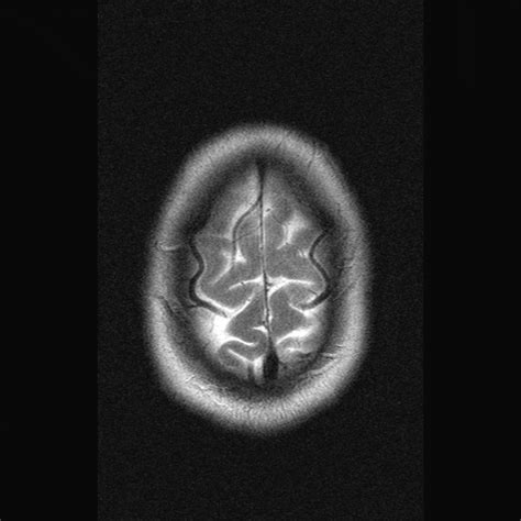 Brain Scan GIF Find Share On GIPHY