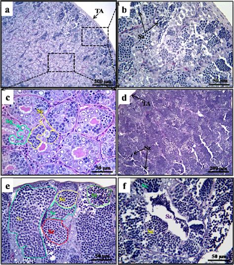 Photomicrographs Of Testicular Sections Of Samples Collected In Winter