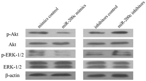Ectopic Expression Of Mir 200c Inhibited Phosphorylation Of Akt And