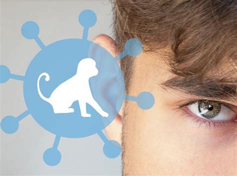 Todo Sobre La Viruela Del Mono O La Viruela Símica Imagen Radio