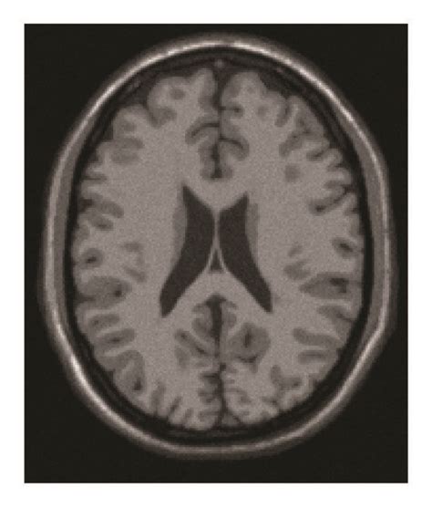 Extracted Independent Components By Fastica Algorithm When The Images