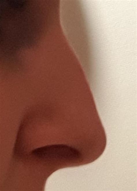 Whats My Type Of Nose R Noses