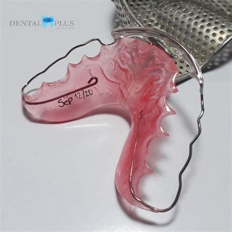 Pin en Детские съёмные протезы | Retenedores dentales, Aparatos de ...