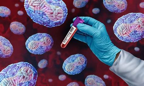 Deadly Sex Virus Cases Surge As Who Admits We Dont Know How Long This