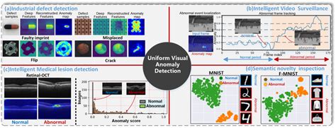Uvad Oriented Visual Anomaly Detection Tasks In Multiple Application