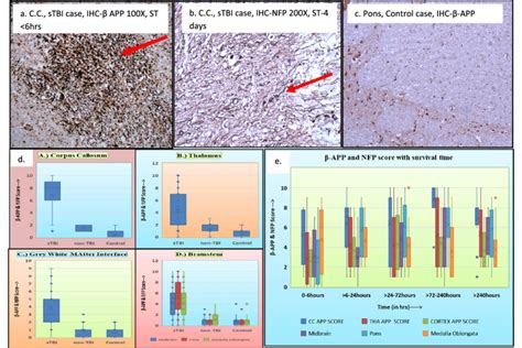 ihc β app nfp a section from corpus callosum cc in stbi case