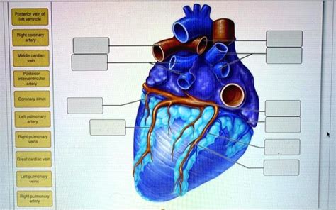 Solved Posterior Vein Of Left Ventricle Ronary Astory Mddie