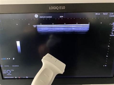 Used Very Good Ge Logiq E10 For Sale Item 1962979 Bimedis