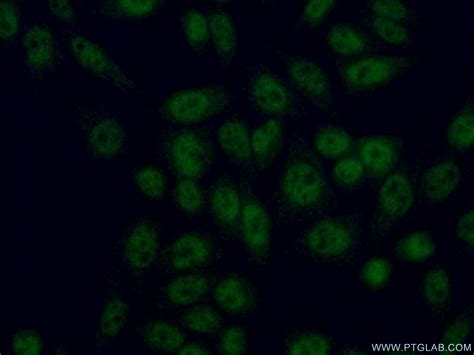 Hoxc4 Antibody 14321 1 Ap Proteintech