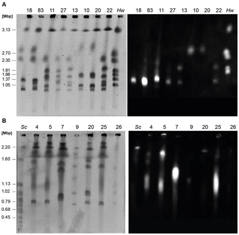 Representative Pfge Karyotypes Of Clinical Candida Auris Isolates Pfge