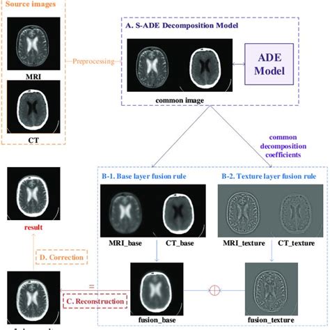 pdf mri and ct medical image fusion based on synchronized anisotropic