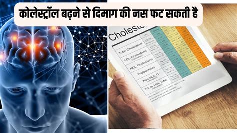 Cholesterol Level Reaching 160 Mgdl To 189 Mgdl Can Lead To Risk Of