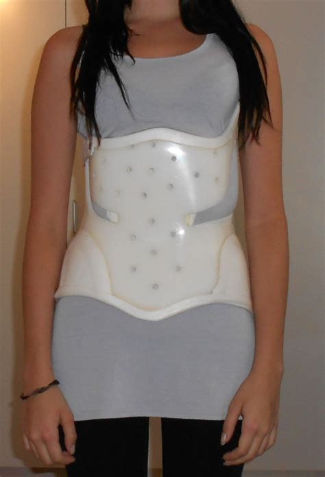 How Long To Wear A Back Brace After Spinal Fusion At Mathew Franz Blog