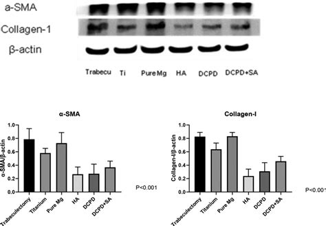 Western Blot Analysis Of α Sma And Collagen 1 Protein Expression